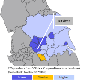 Data Observatory for Kirklees – CKD_map – Data Observatory for Kirklees